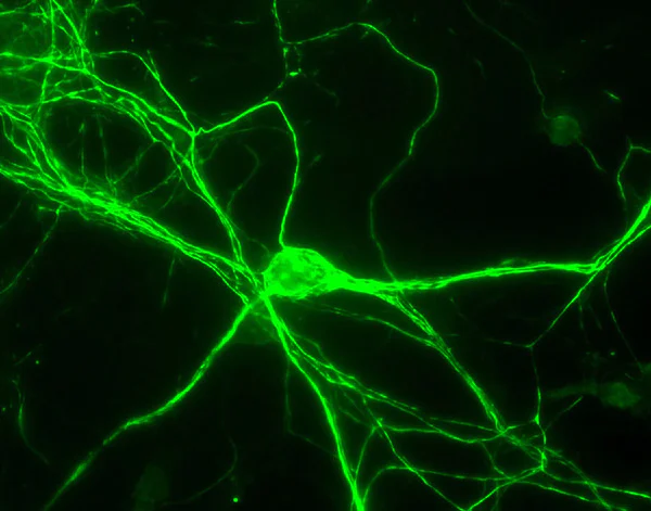 Neurofilament heavy polypeptide / NFH antibody (ab4680) | Abcam