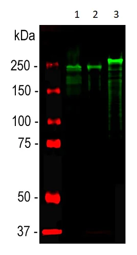 Neurofilament heavy polypeptide / NFH antibody (ab4680) | Abcam