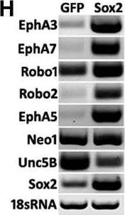 Neurofilament heavy polypeptide / NFH antibody (ab4680) | Abcam