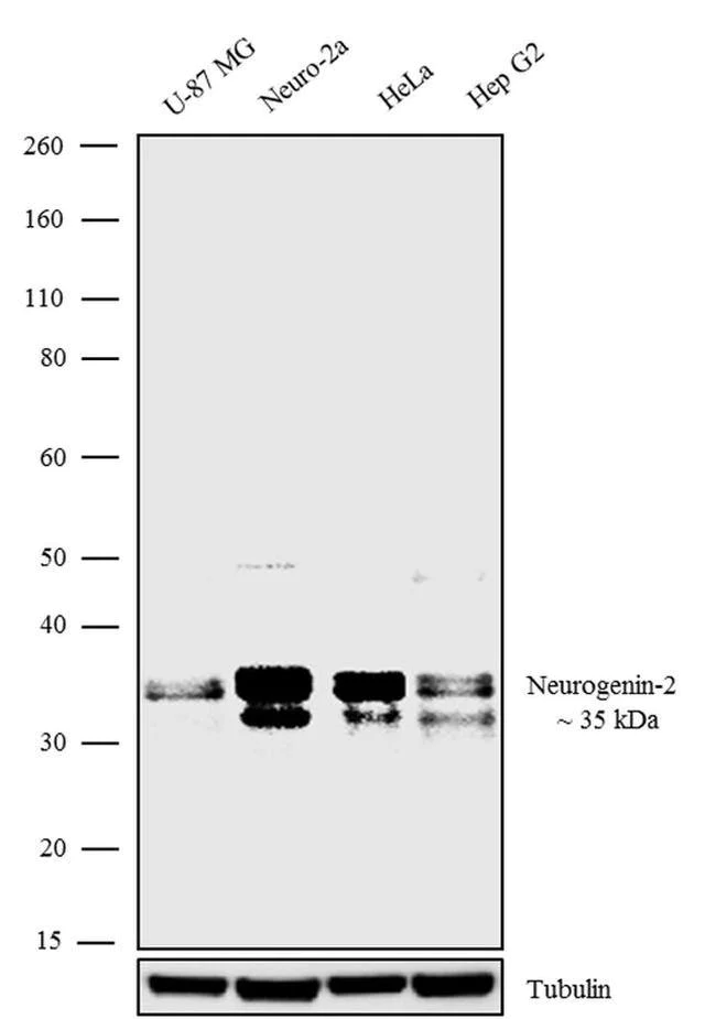 Anti-Neurogenin 2/NGN2 Antibody [RP23040214] (ab313486) | Abcam