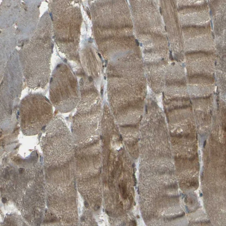 Anti-Nexilin/F-actin-binding protein antibody (ab272559) | Abcam