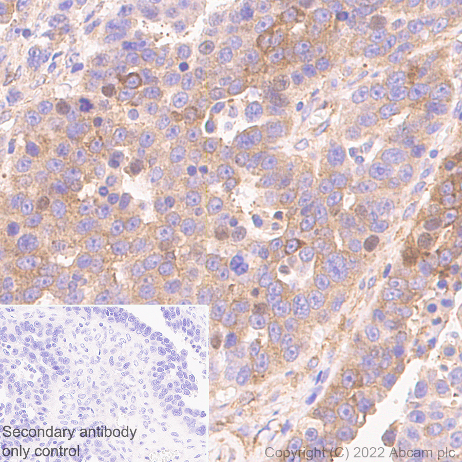 Anti-NF-kB p65 antibody [E379] - Chicken IgY (Chimeric) - BSA and Azide ...