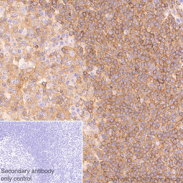 Anti-NF-kB p65 antibody [E379] - Chicken IgY (Chimeric) - BSA and Azide ...