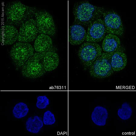Anti-NF-kB p65 antibody [EP2161Y] - BSA and Azide free (ab246347) | Abcam