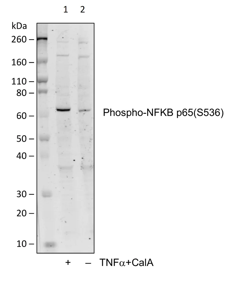 NF-kB p65(磷酸化S536)抗体[NFKBp65S536-B7] (ab278777)| Abcam中文官网