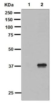 NF-kB Signaling Pathway Antibody Sampler Panel (ab228529) | Abcam