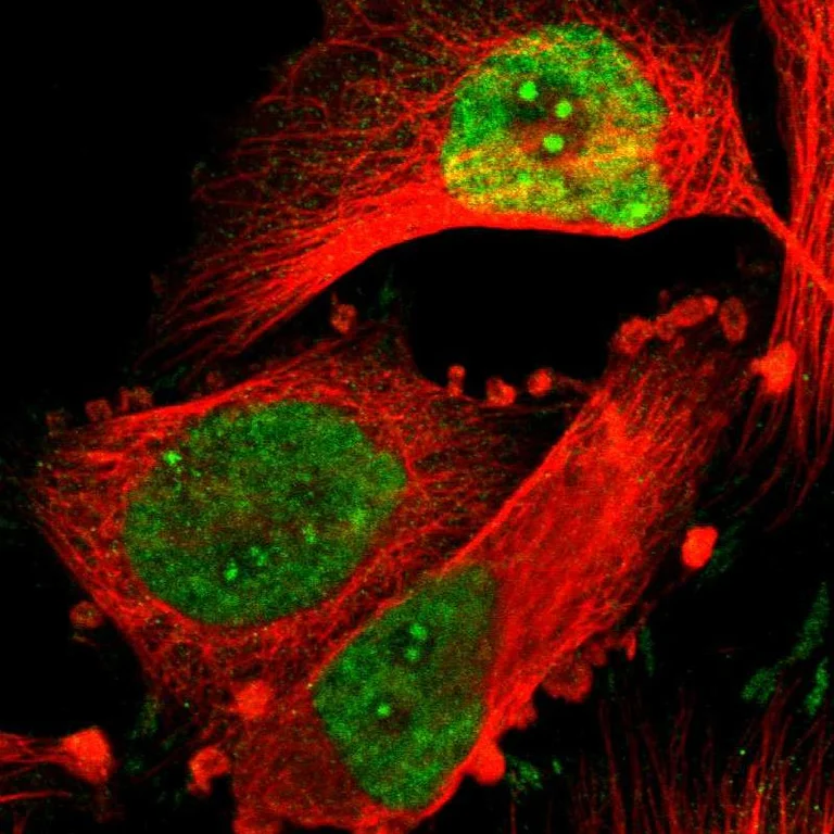 Anti-NFIB Antibody (ab327182) | Abcam中文官网