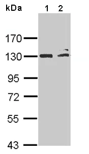 Anti-NFkB Inducing Kinase NIK antibody - N-terminal (ab137671) | Abcam
