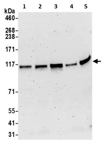 Anti-NFkB p100/NFKB2 antibody (ab264236) | Abcam