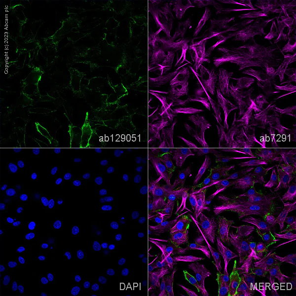 Anti-NG2 antibody - rabbit polyclonal (ab129051) | Abcam