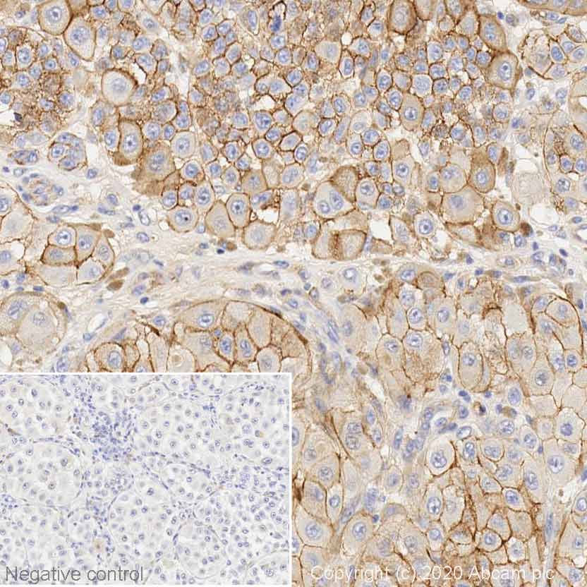 Anti-NG2 antibody - rabbit polyclonal (ab129051) | Abcam