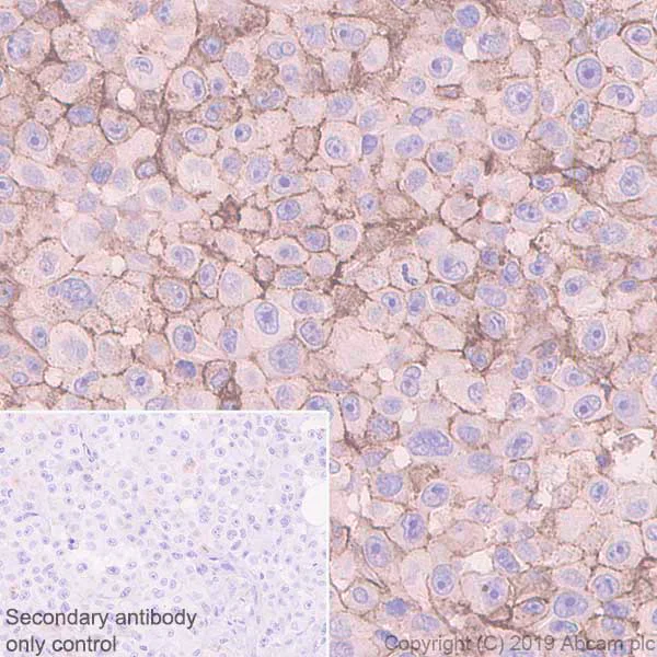Anti-NG2 antibody [EPR22410-145] (ab255811) | Abcam