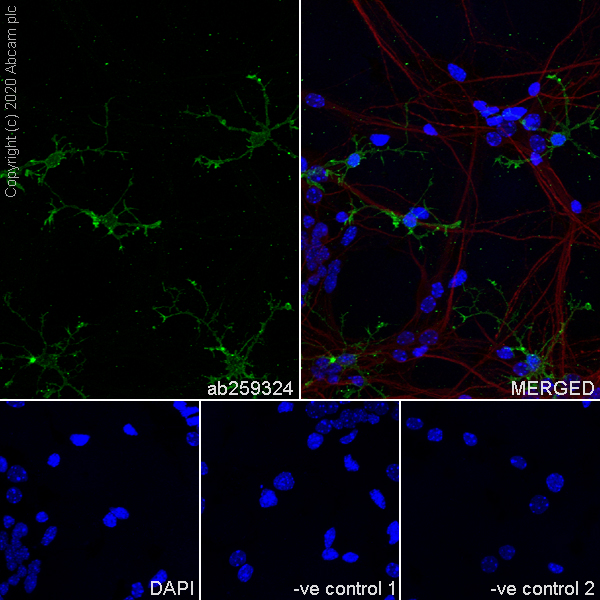 Anti-NG2 antibody [EPR23752-147] Rabbit monoclonal (ab259324) | Abcam