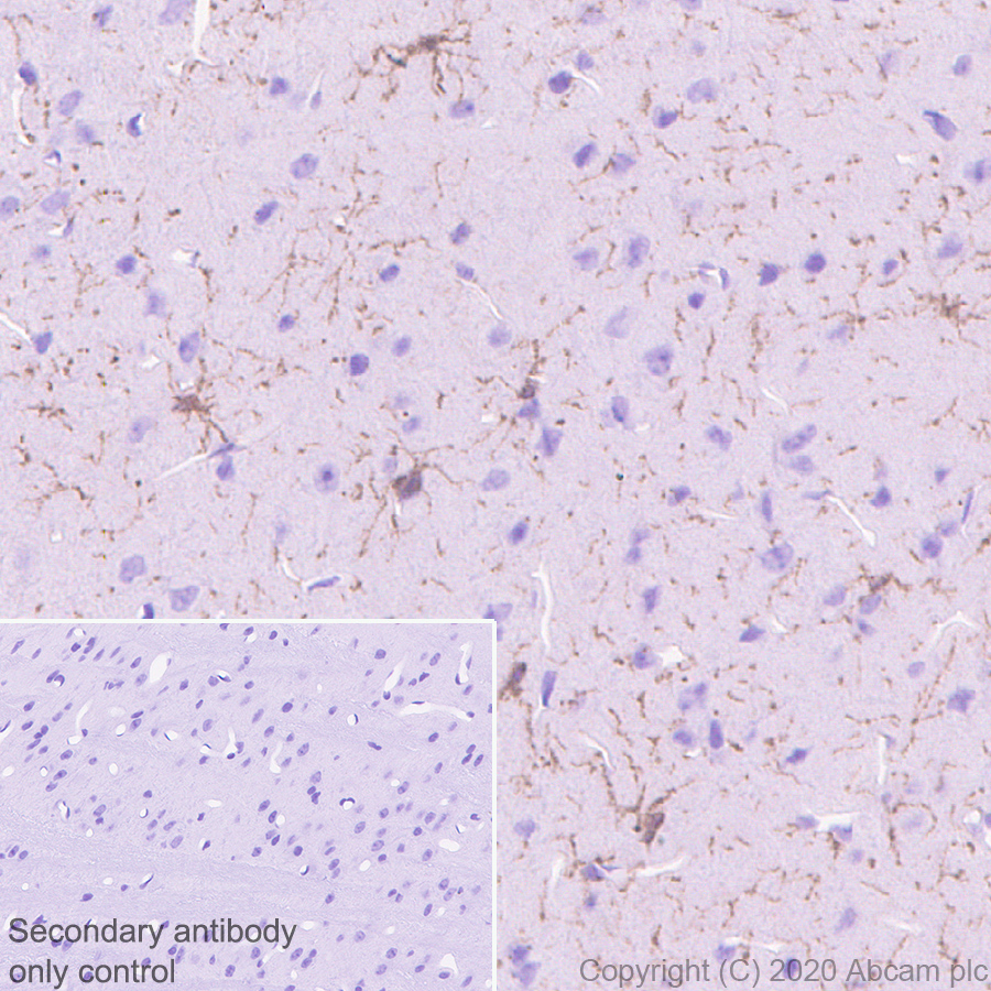 Anti-NG2 antibody [EPR23752-147] Rabbit monoclonal (ab259324) | Abcam