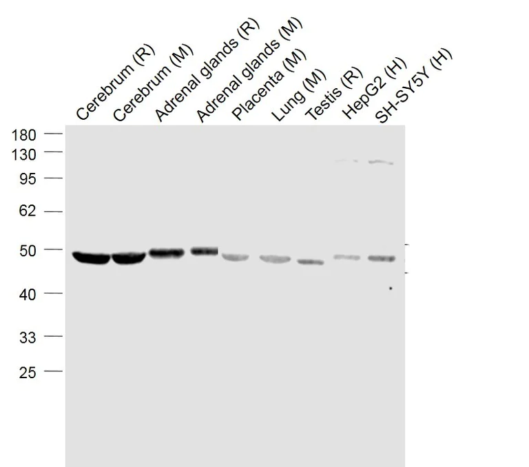 Anti-Nicotinic acetylcholine receptor alpha 7 antibody (ab216485) | Abcam