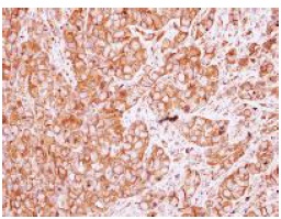 Anti-Nicotinic Acetylcholine Receptor beta/CHRNB1 antibody (ab126234) | Abcam