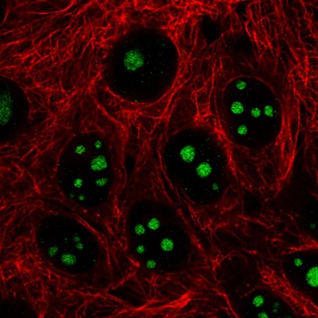 Anti-NIFK antibody [CL2240] - Nucleolar Marker (ab211871) | Abcam