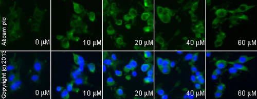 Nitrendipine, L-type Ca2+ channel blocker (CAS 39562-70-4) | Abcam