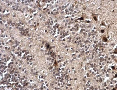 Anti-NKAP antibody (ab229096) | Abcam