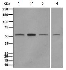 Anti-NMD3 antibody [EPR11979(B)] (ab170898) | Abcam