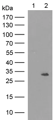 Nmnat1/NMNAT抗体[OTI1F7] (ab118270)| Abcam中文官网