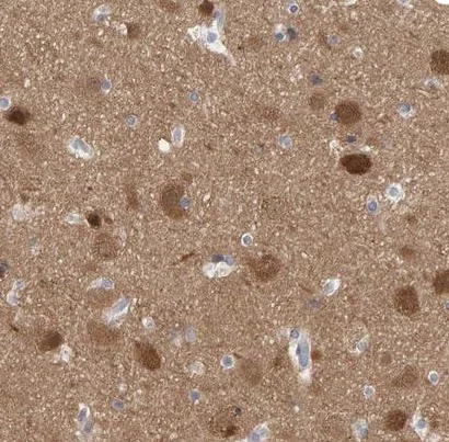 Anti-Norbin antibody (ab224451) | Abcam