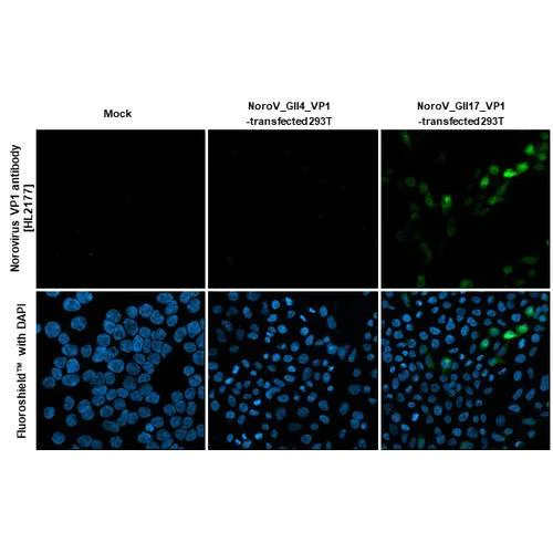 Anti-Norovirus VP1 antibody [HL2177] (ab317154) | Abcam