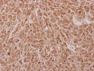 Anti-NOSIP antibody (ab102087) | Abcam