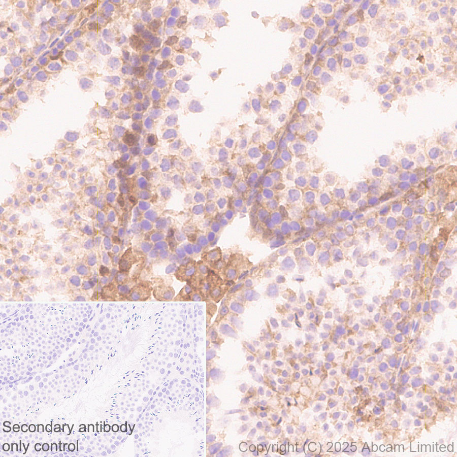 Anti-Notch2 antibody [EPR23715-107] (ab323806) | Abcam