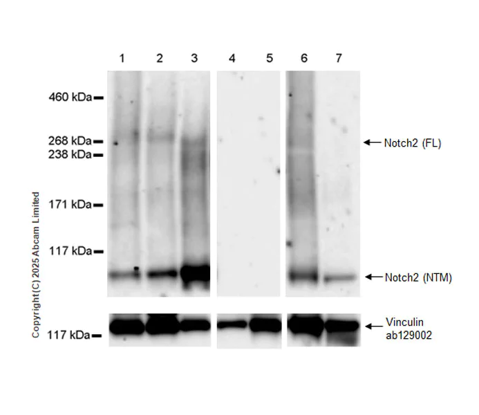 Anti-Notch2 antibody [EPR23715-107] (ab323806) | Abcam