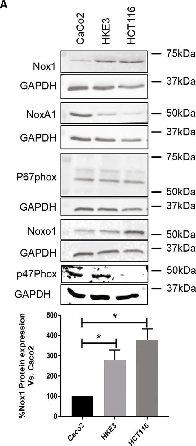 Anti-NOX1 antibody (ab121009) | Abcam