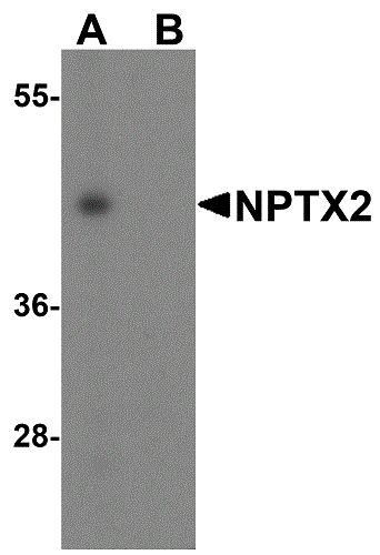 Anti-NPTX2 antibody (ab69858) | Abcam