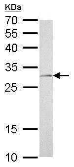 Anti-NQO1 antibody (ab227520) | Abcam