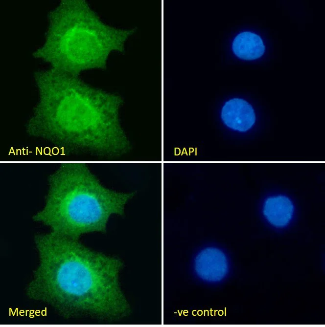 Anti-NQO1 antibody (ab2346) | Abcam