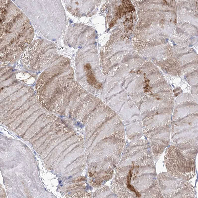 Anti-NRAP antibody (ab122427) | Abcam