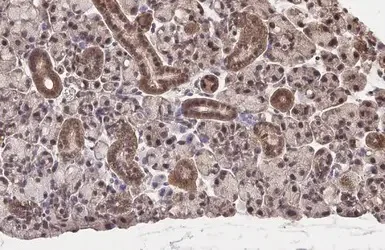 Anti-NRF2 antibody [HL1021] - BSA and Azide free (ab313825) | Abcam