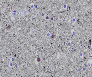 Anti-NSE antibody [EP12483-102] - Neuronal Marker (ab189517) | Abcam