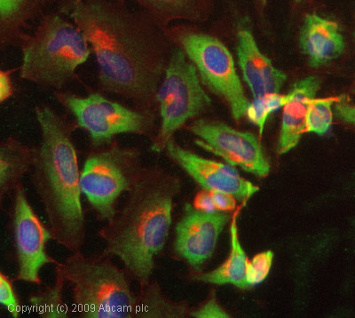 Anti-NSE antibody - Neuronal Marker (ab53025) | Abcam