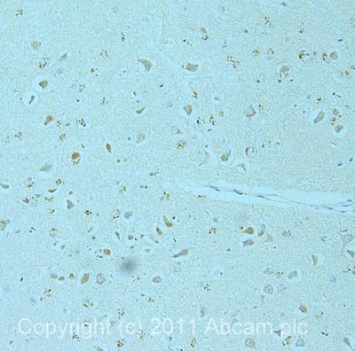 NSMase2抗体 (ab68735)| Abcam中文官网