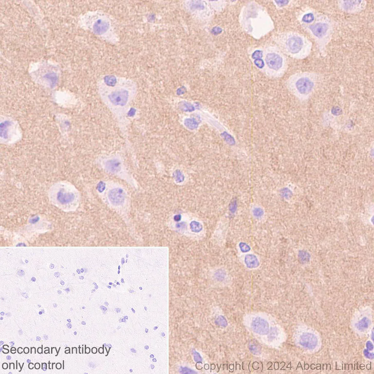 Anti-NSMase2 antibody [EPR29180-87] (ab322660) | Abcam