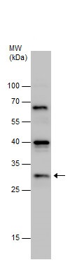 Anti-NUBPL antibody (ab229670) | Abcam