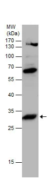 Anti-NUBPL antibody (ab229670) | Abcam