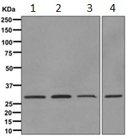 Anti-NUBPL antibody [EPR11833] (ab171741) | Abcam