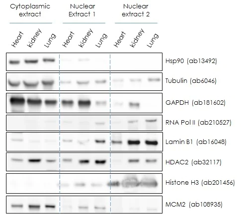 Nuclear Extraction试剂盒- Soluble / Insoluble Fractions (ab219177)| Abcam中文官网