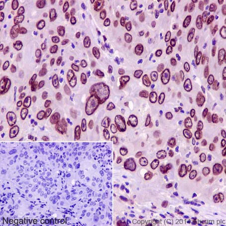 Nuclear Marker (Lamin A + C, SC35, KDM1/LSD1, Fibrillarin, HP1 alpha ...