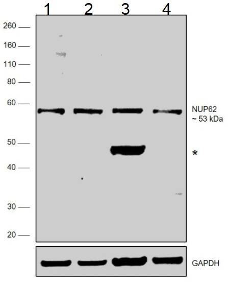 Anti-Nuclear Pore O-Linked Glycoprotein antibody [RL1] (ab2734) | Abcam