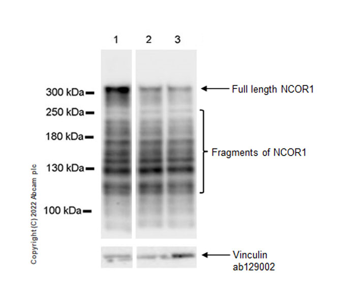 Anti-Nuclear Receptor Corepressor NCoR antibody [EPR23834-46] (ab300615 ...