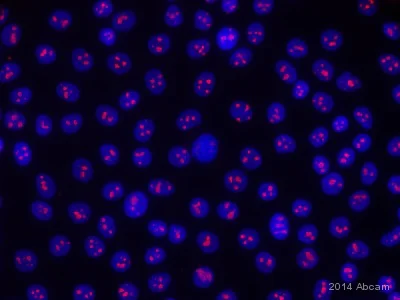 Anti-Nucleolin antibody [364-5] (ab136649) | Abcam