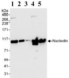 Anti-Nucleolin antibody (ab70493) | Abcam