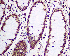 Anti-Nucleolin antibody [EPR7952] (ab129200) | Abcam